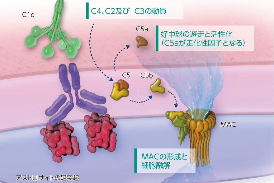 NMOSD | C5Neurology | 補体C5関連神経疾患情報サイト by Alexion